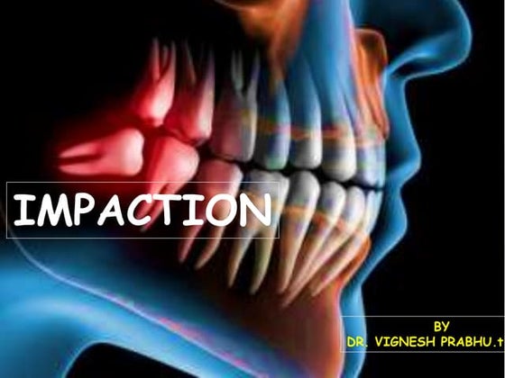 Radiographic assessment of impacted teeth | PPTX