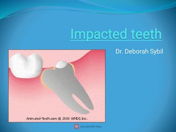 Radiographic assessment of impacted teeth | PPTX