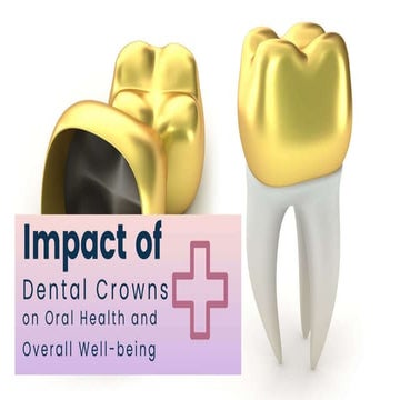 Impact of Dental Crown on Oral Health and Overall Well-being | PPT