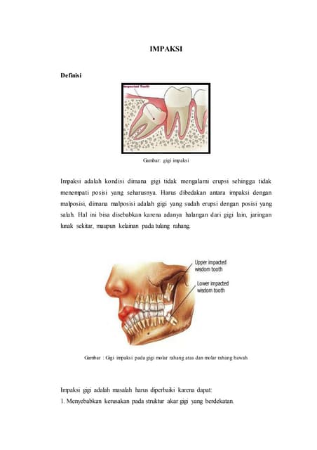 trauma oklusi: teganga yang berlebuh dari struktur pendukug gigi | PPT
