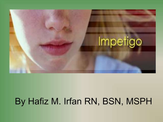 Impetigo | PPTX