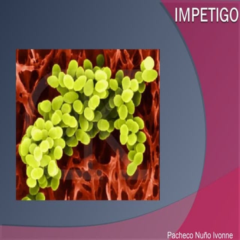 Impetigo | PDF