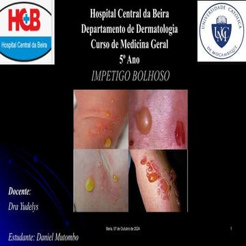 Impetigo Bolhoso Dermatopatologia O Impetigo é Uma Infecção