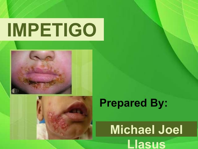 Impetigo | PPTX