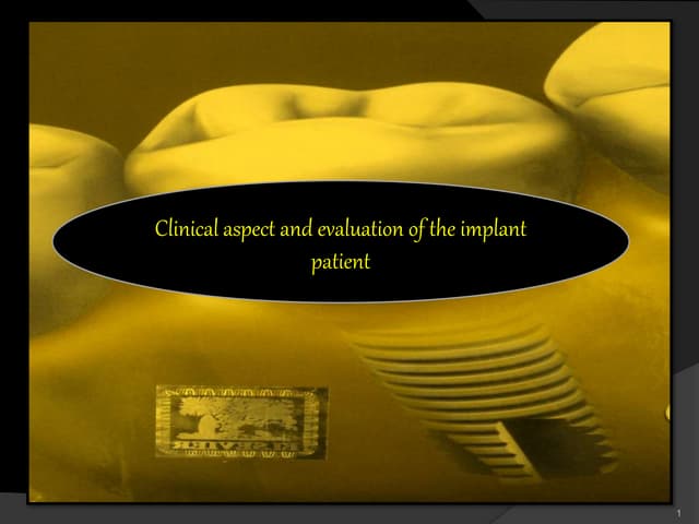 Selection of patient for dental implant | PPTX | Dental Health | Diseases and Conditions