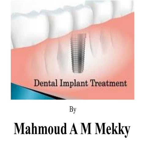 types of fixed dental prosthesis include crowns | PDF