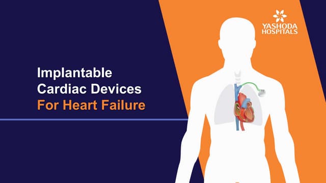 Implantable Cardioverter Defibrillators -ICD | PPTX