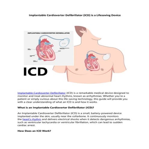 Implantable Cardioverter Defibrillator _theheart.pdf