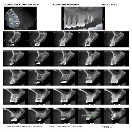 Implant Case_CROSS-SECTIONS.pdf