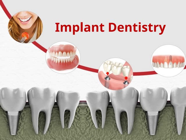 Impression techniques in implants | PPTX