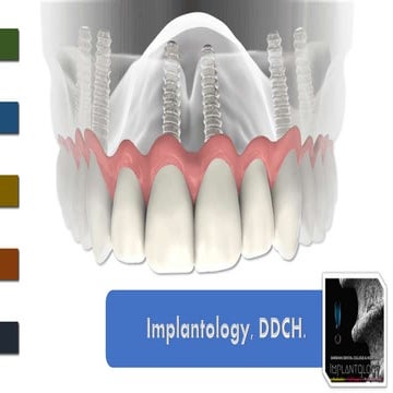 Implant Evaluation.pptx
