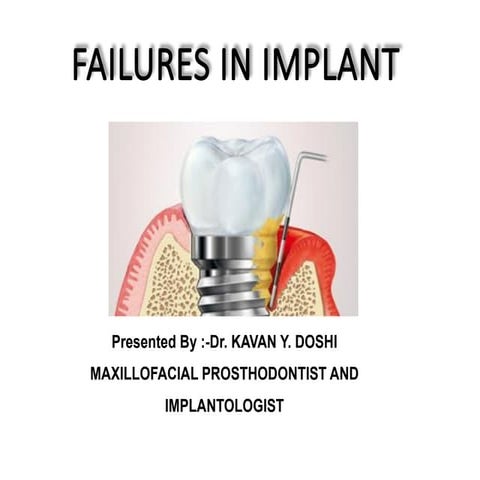Implant Failure BY DR KAVAN DOSHI MAXILLOFACIAL PROSTHODONTIST AND ...