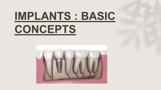 Implant components and function | PPT