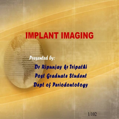 RADIOGRAPHS FOR DENTAL IMPLANT.pptx