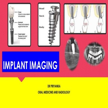 IMPLANT IMAGING (DENTAL IMPLANT IMAGING)- DR PRIYANKA | PPTX