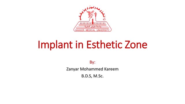 Esthetics in Implant Dentistry | PPTX