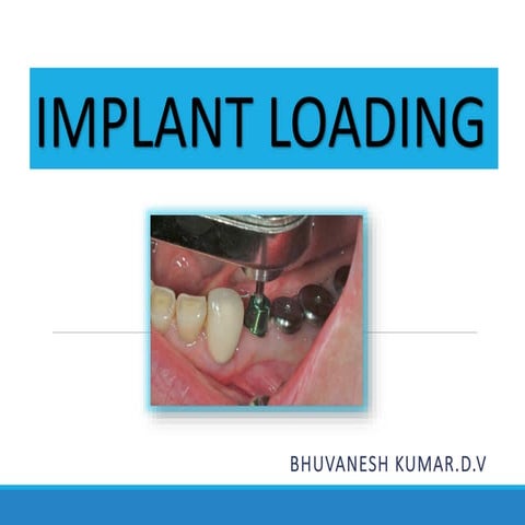 Implant loading | PPTX