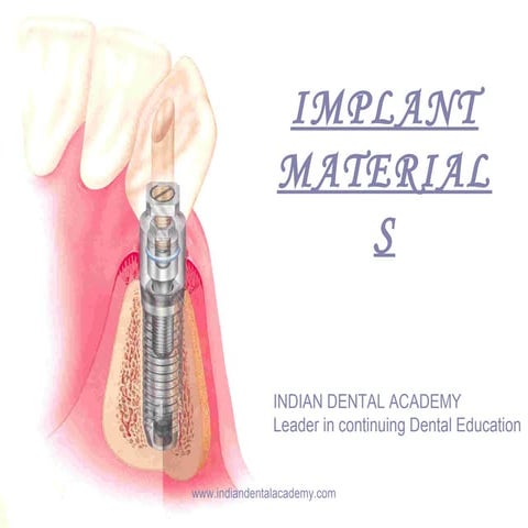 Implant materials final/prosthodontic courses | PPT