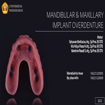 IMPLANT OVERDENTURES BEY NURIL.pptx | Dental Health | Diseases and ...