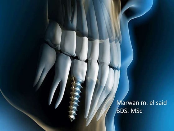 Standard surgical procedure for implant placement | PPT