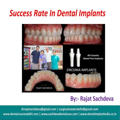 Implant success rate , all about dental implants , implant success ...