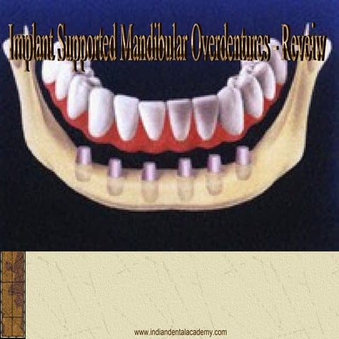 Implant supported mandibular overdenture/ lingual orthodontics courses ...