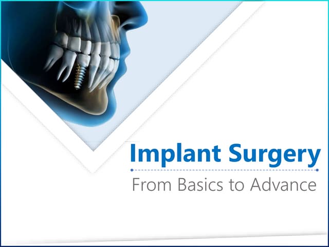Selective grinding | PPTX