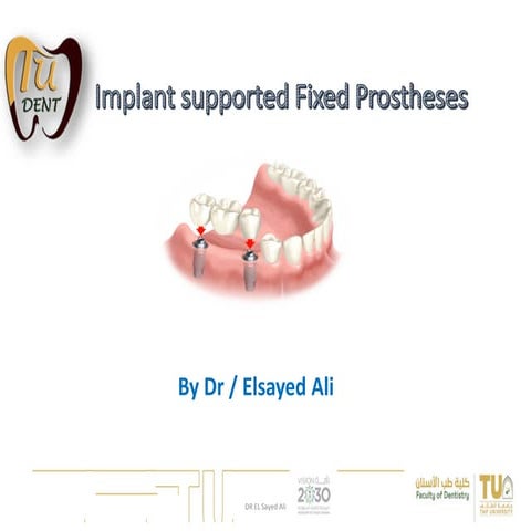 Impl supported prosth taif | PPT