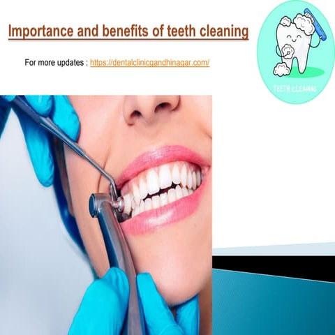 Importance and Benefits of Teeth Cleaning | PDF