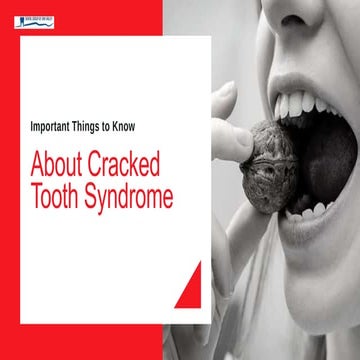 Important Things to Know About Cracked Tooth Syndrome | PPTX