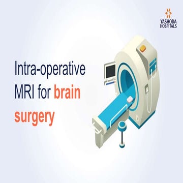 Intraoperative MRI (iMRI) for Brain Surgery in Hyderabad | PPT