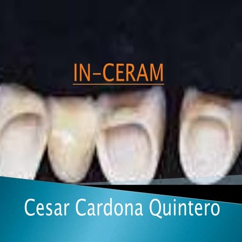 In-Ceram | PPTX
