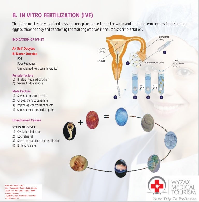 In vitro fertilization ivf india - Wyzax Infertility Consultant India