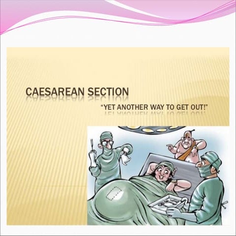 Indications for Surgical Delivery...pptx