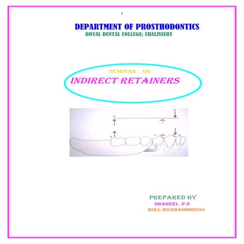 Indirect retainers | PPTX