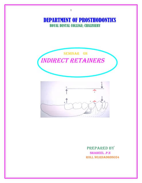 Biomechanical considerations in removable partial denture design | PPTX ...