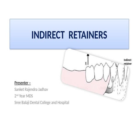 Indirect retainers | PPTX