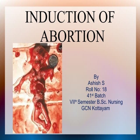 medical termination of pregnancy | PPTX