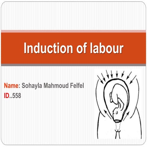 Induction of labor | PPT