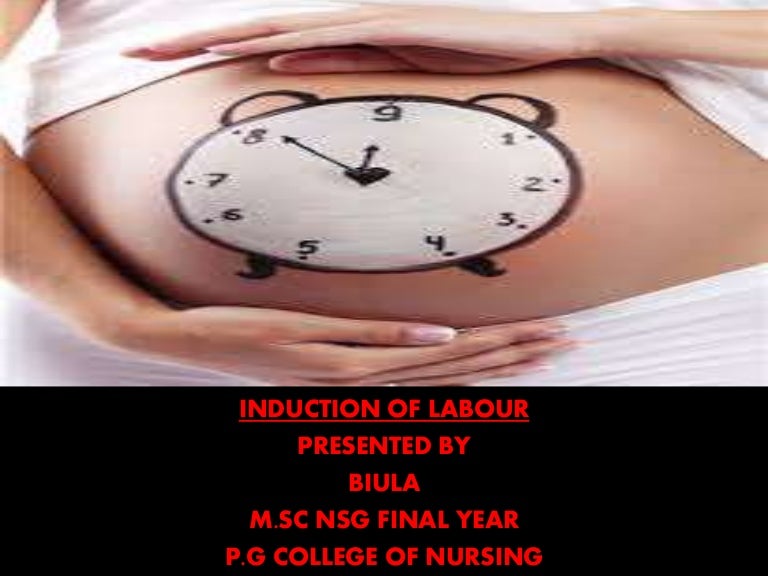 Induction Of Labour Ppt