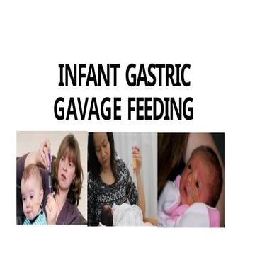 INFANT GAVGE FEEDING 2021 PowerPoint Presentation | PPTX