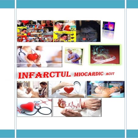 Infarctul miocardic acut | PDF
