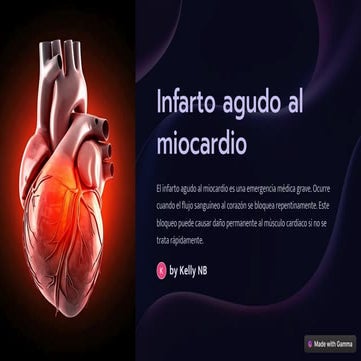 INFARTO AL MIOCARDIO.pdf
