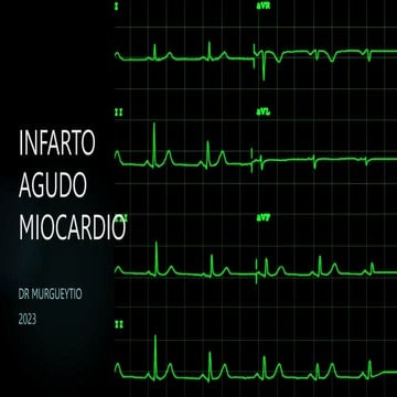 INFARTO AGUDO MIOCARDIO ELECTROCARDIOGRAMA | PPTX