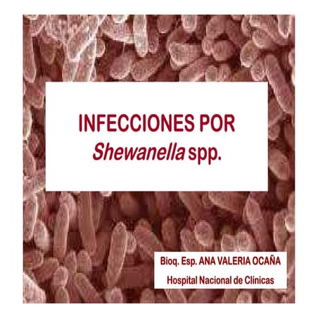 Infecciones por-Shewanella spp---------- | PDF