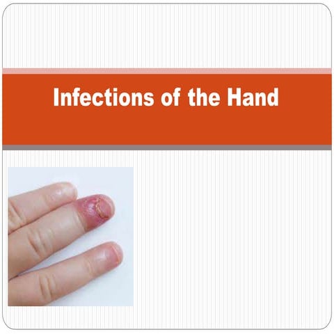 Infections of the hand(maheswari) | PPTX