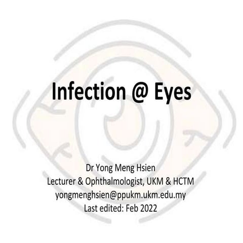 Infections @ Eye | PPT
