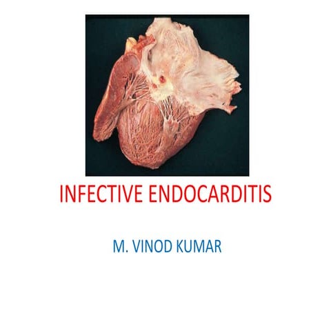 Infective endocardiitis | PPTX | Heart and Cardiovascular Diseases ...