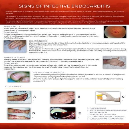 Infective Endocarditis Signs And Symptoms Lightning Learning: