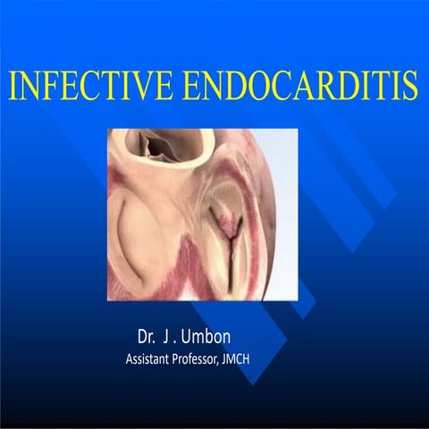 Infective endocarditis | PPT